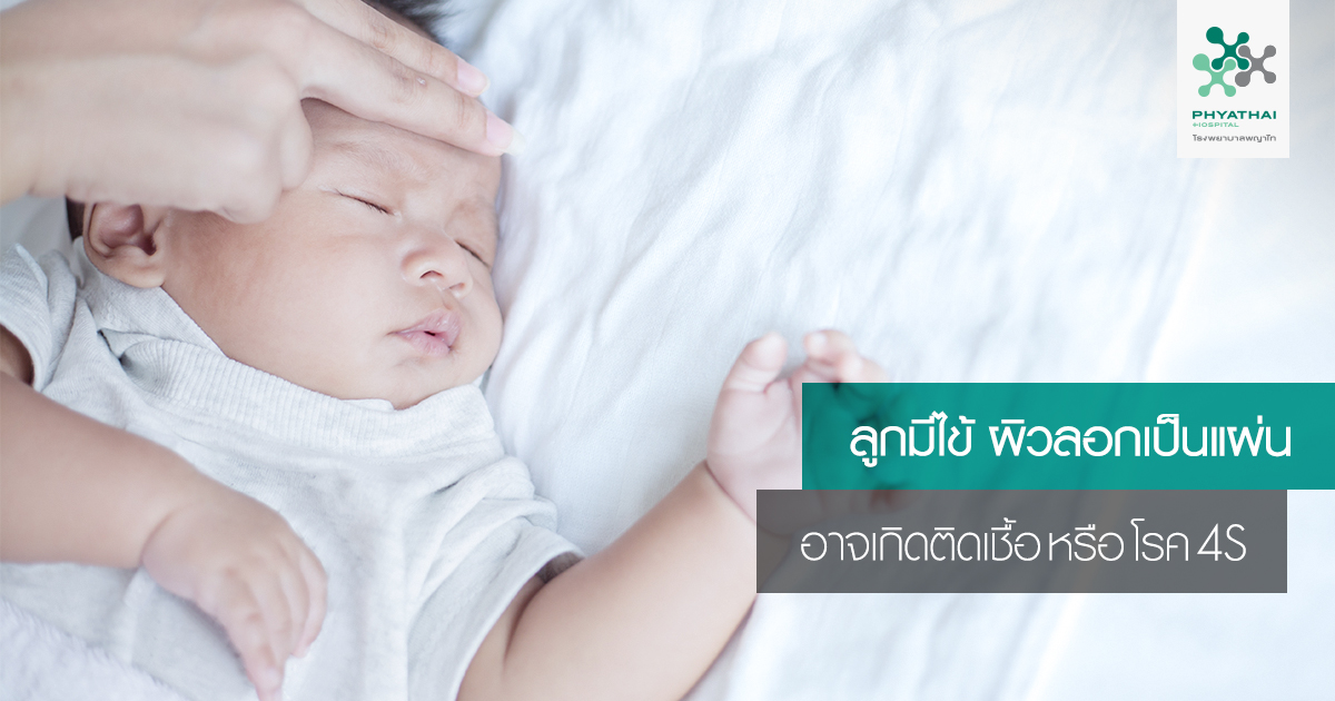 โรค 4S หรือ Staphylococcal Scalded Skin Syndrome โรคยอดฮิตในเด็ก ...