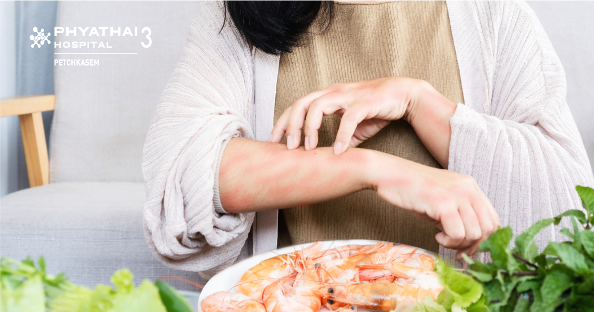 Anaphylaxis: Life-Threatening Allergic Reactions | Phyathai Hospital