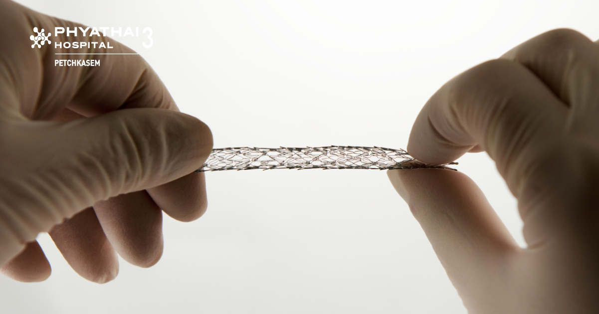 Endovascular surgery | Phyathai Hospital