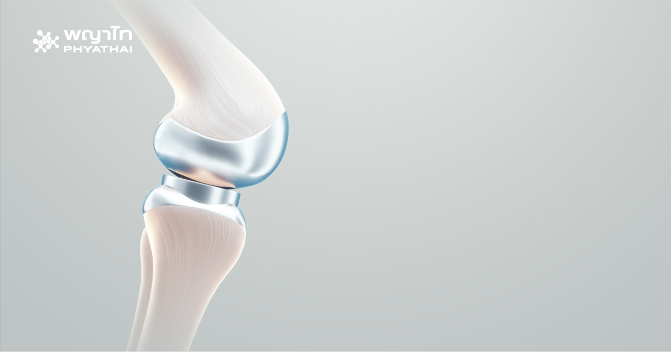 ロボット支援による人工膝関節置換手術 | Phyathai Hospital