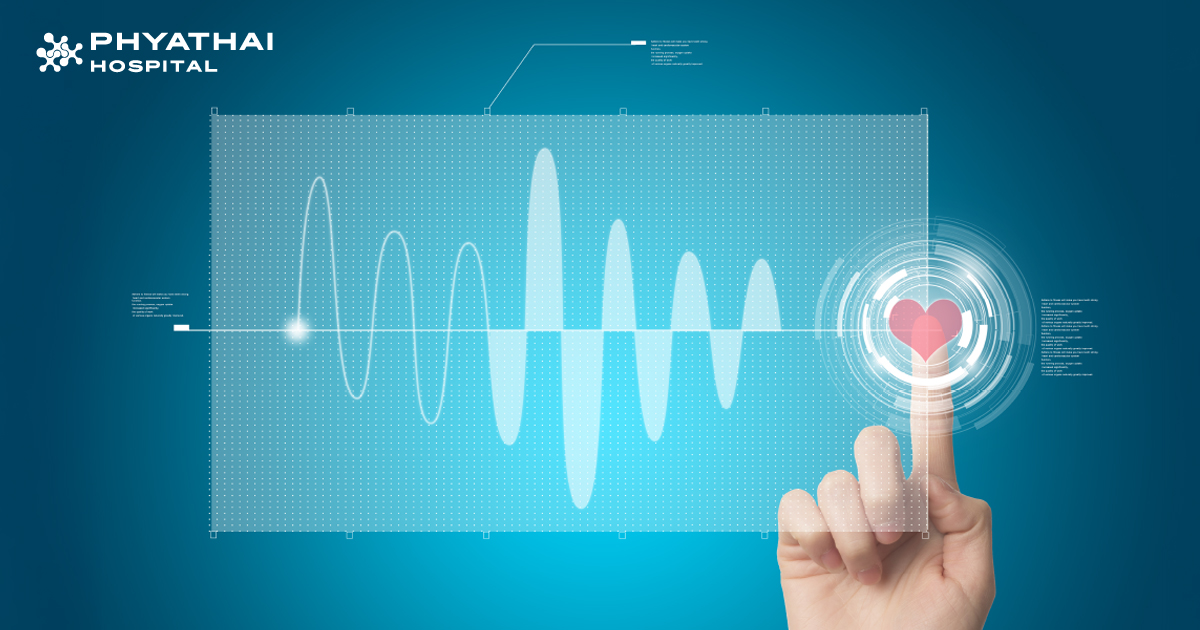 Atrial Fibrillation (AFib): Symptoms, Causes, and Treatment | Phyathai ...